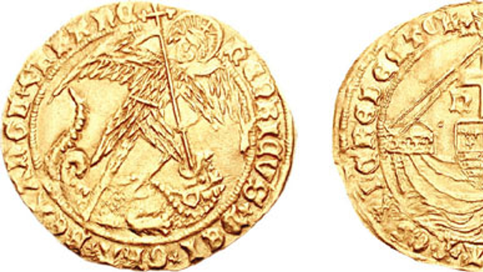 Scrofula Medieval The King's Touch: A History Of 'Magical Royalty'